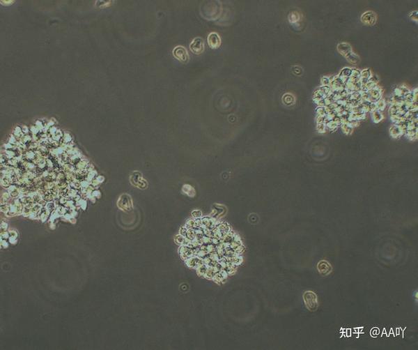 细胞学堂｜NK-92&NK-92/MI细胞培养（转载） - 知乎