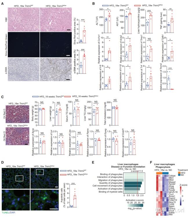 文献学习002——TREM2 依赖的胞葬调控肝脏炎症和NASH发展 - 知乎