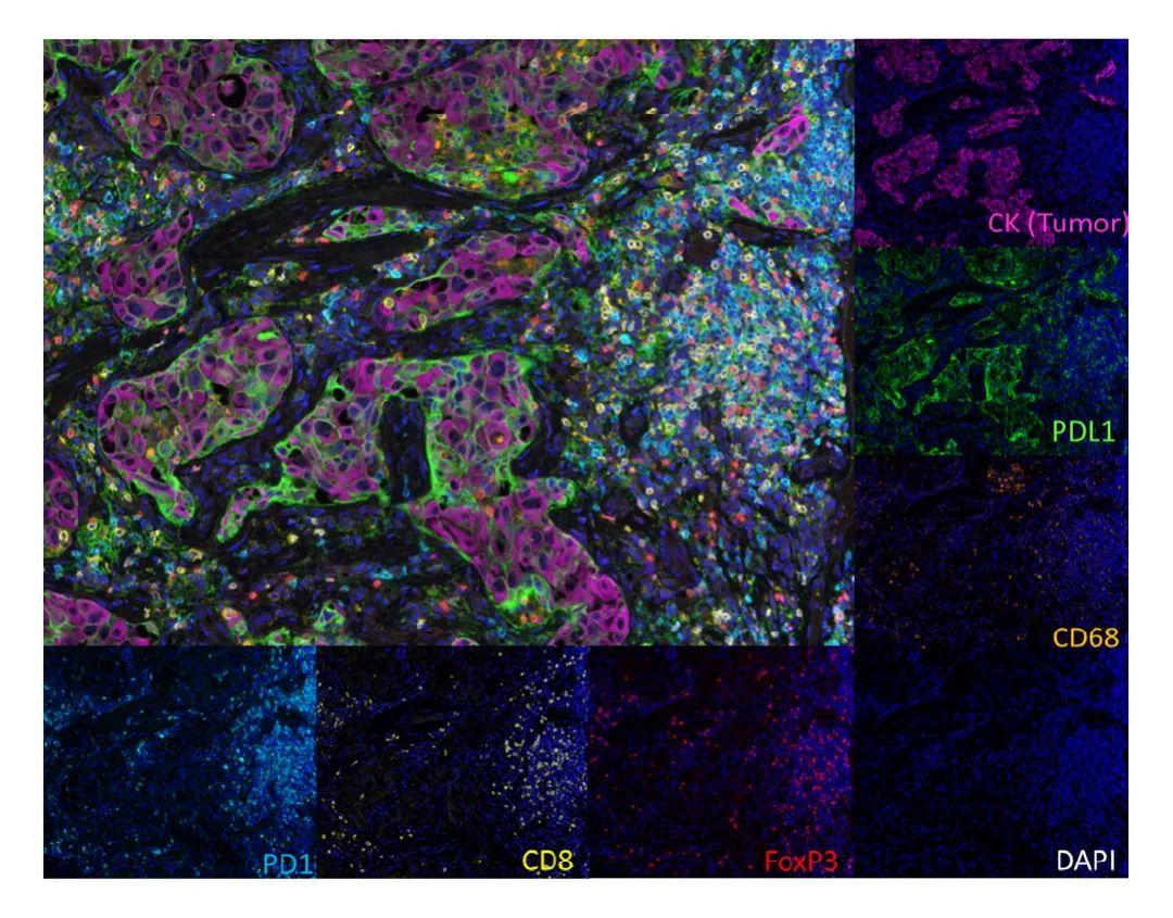 干货分享 | 多重荧光免疫组化技术 (mIHC) - 知乎