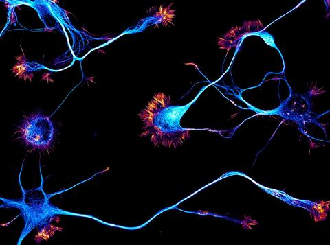 ImageJ实用教程汇总 - 知乎