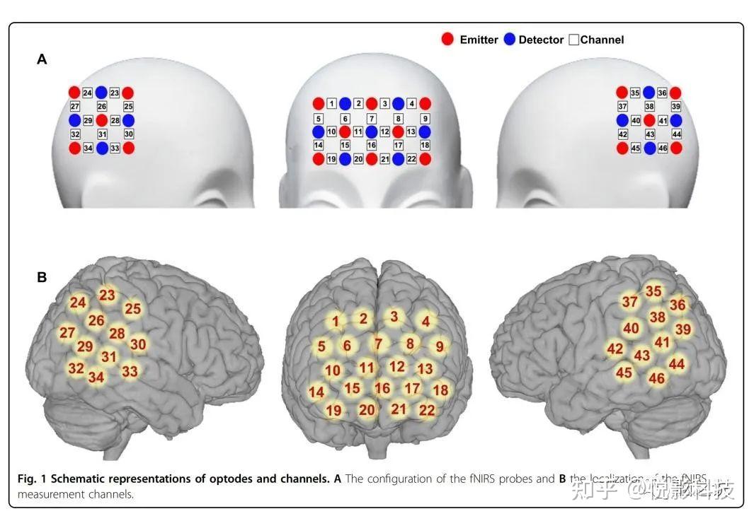 皮层网络内在组织预测状态焦虑：一项fNIRS研究 - 知乎