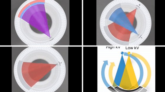 收藏！全球CT技术变迁史 - 知乎