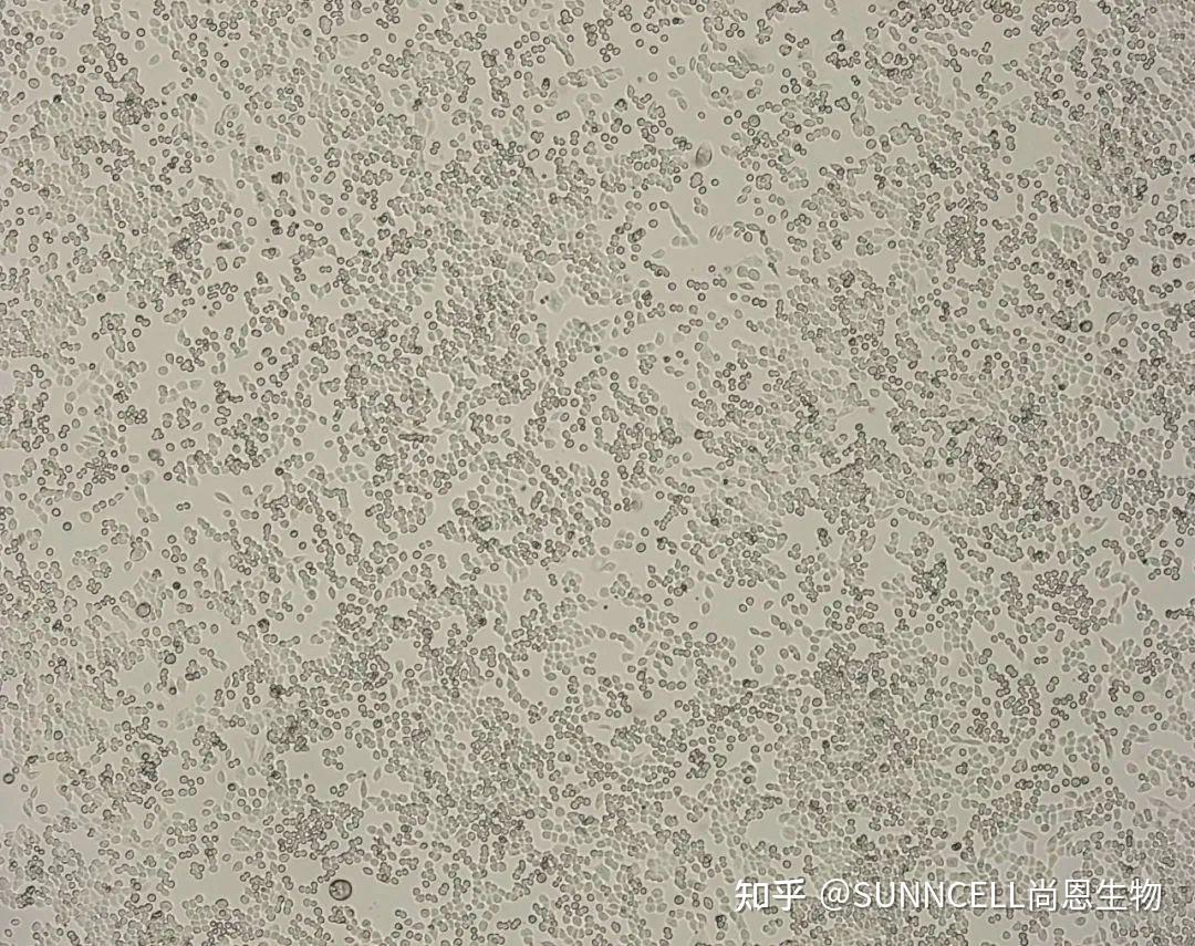 LLC(小鼠肺癌细胞)培养教程 - 知乎