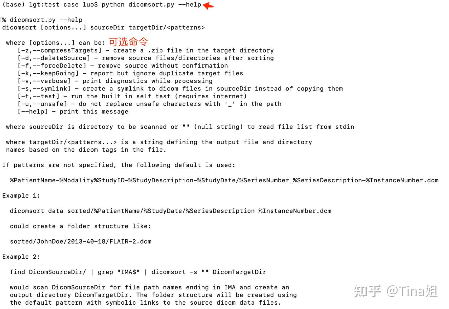 数据预处理 Sort 乱序dicom 文件 知乎