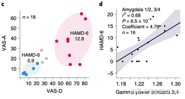 【THERAPY】Closed-loop neuromodulation in an individual with treatment ...