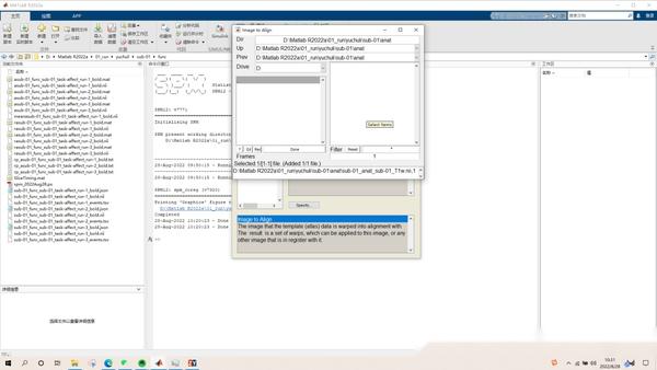 如何用SPM完成fMRI数据的预处理【任务态】 - 知乎