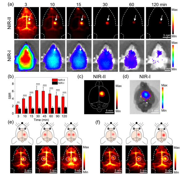 纳米材料 | 超声诱导以打开血脑屏障的 NIR-II 荧光可视化，用于使用ICG吲哚菁绿微泡增强光热治疗胶质母细胞瘤 - 知乎