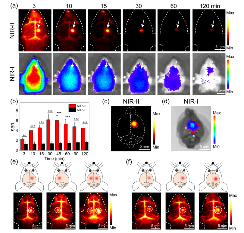 纳米材料 | 超声诱导以打开血脑屏障的 NIR-II 荧光可视化，用于使用ICG吲哚菁绿微泡增强光热治疗胶质母细胞瘤 - 知乎