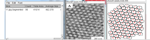 Imagej图像处理实践（ImageJ学习-图像处理 545367350） - 知乎