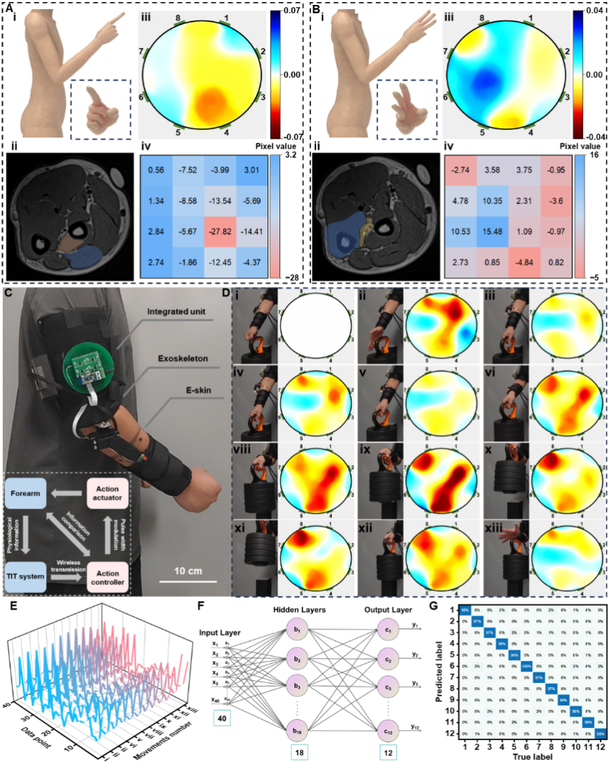 Science Advances | 用于生物组织无创和动态成像的可穿戴摩擦电阻抗断层扫描系统 - 知乎