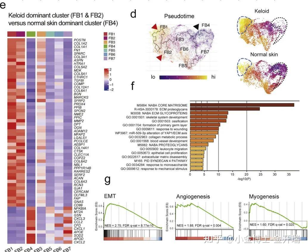 皮肤病空转案例：瘢痕疙瘩单细胞和空间转录组学综合分析文献解读 - 知乎