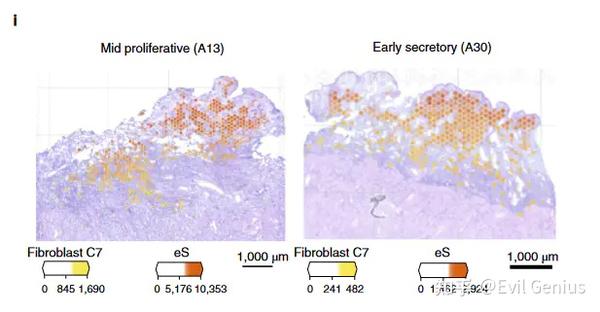 单细胞空间联合分析方法之文献运用篇 - 知乎