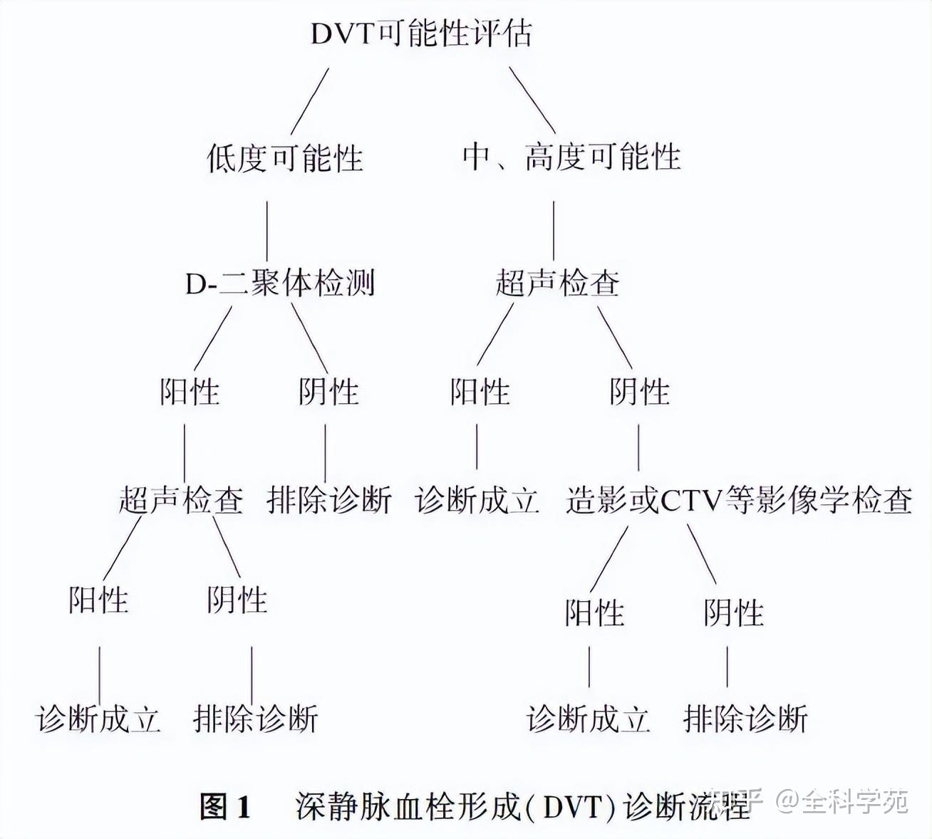 深静脉血栓形成 DVT 的诊治 - 知乎