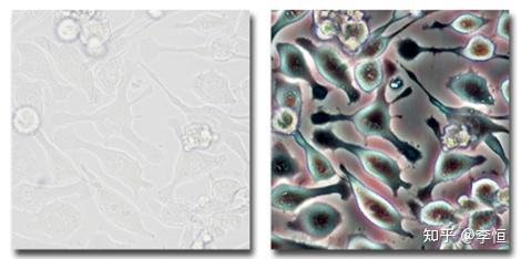 泽尼克(Zernike)的贡献 - 知乎