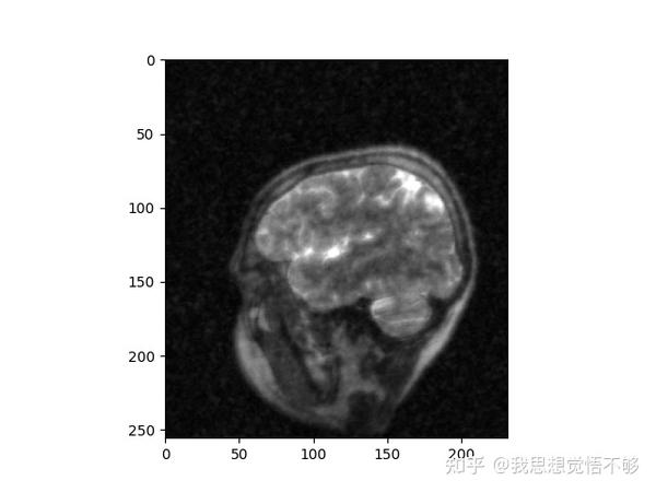 MRI重建中的小实验（python） - 知乎