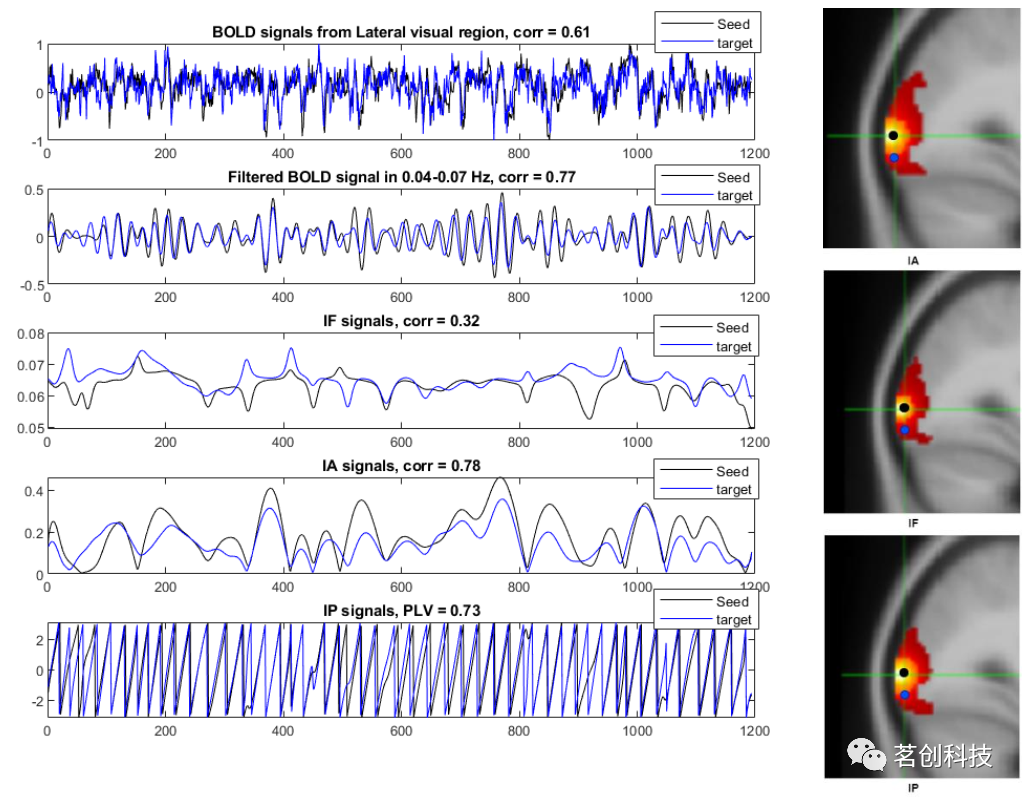 fMRI时间序列振幅和相位对功能连接分析的影响 - 知乎