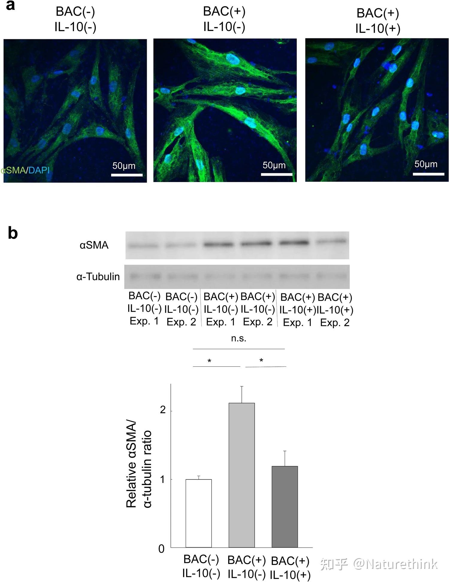 苯扎氯铵诱导的 Tenon 囊成纤维细胞的肌成纤维细胞转分化受到角膜上皮细胞共培养或白细胞介素10 的抑制 - 知乎