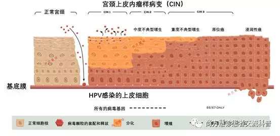 女性不可不知的宫颈癌发病风险和预防手段 知乎