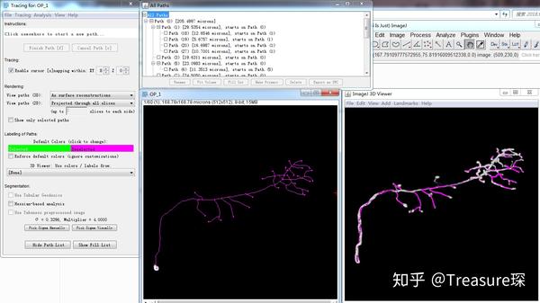 ImageJ实用技巧——Sholl Analysis（一）(插件篇) - 知乎