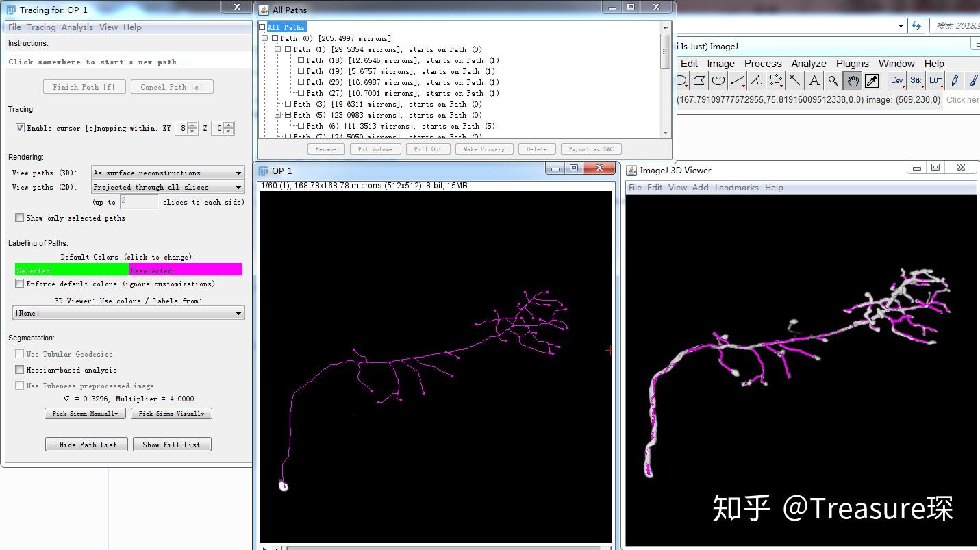 ImageJ实用技巧——Sholl Analysis（一）(插件篇) - 知乎