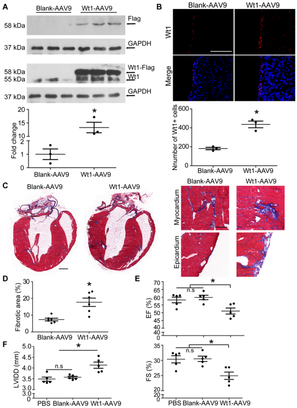 Cell Death Differ︱尹海芳团队揭示杜兴肌肉萎缩症新作用机制：转录因子Wt1激活心外膜细胞分化促进心肌纤维化 - 知乎