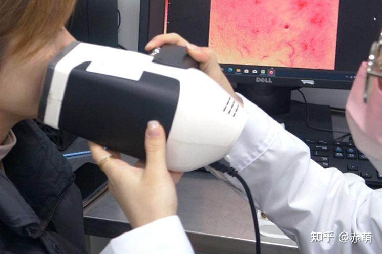 技术解读|Antera 3D：一款使用皮肤3D成像技术的手持式便携照相机 - 知乎