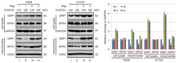 Cell Death Dis︱刘朋飞团队合作发现COX7A1通过调节线粒体代谢增强人NSCLC细胞对胱氨酸缺失诱导的铁死亡敏感性 - 知乎