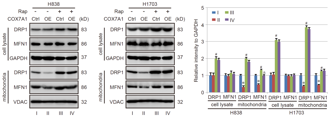 Cell Death Dis︱刘朋飞团队合作发现COX7A1通过调节线粒体代谢增强人NSCLC细胞对胱氨酸缺失诱导的铁死亡敏感性 - 知乎