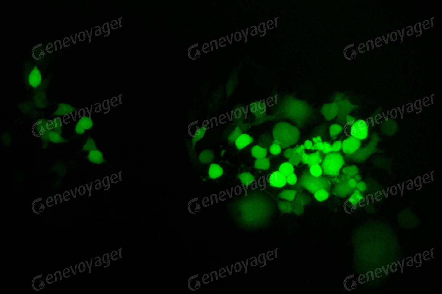 【溶瘤病毒】水疱性口炎病毒（VSV） - 知乎