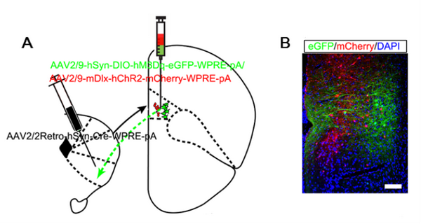 【客户文章】空军军医大学李云庆教授、董玉琳副教授团队在dmPFC-vlPAG投射神经元参与疼痛维持阈值和抗焦虑行为研究取得新进展 - 知乎