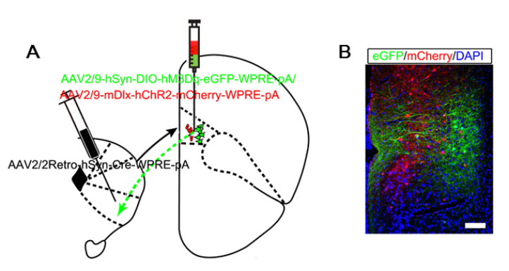 【客户文章】空军军医大学李云庆教授、董玉琳副教授团队在dmPFC-vlPAG投射神经元参与疼痛维持阈值和抗焦虑行为研究取得新进展 - 知乎