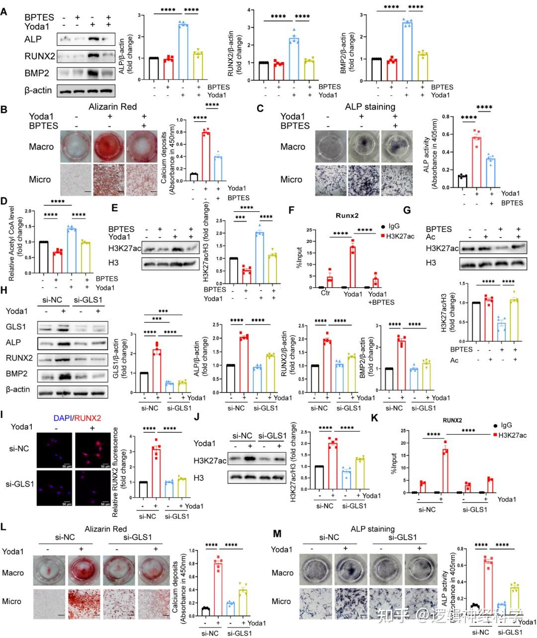 Sci Adv︱南方医科大学曾庆春/许顶立团队揭示Piezo1通过调控谷氨酰胺代谢促进钙化性主动脉瓣疾病发生发展的新机制 - 知乎