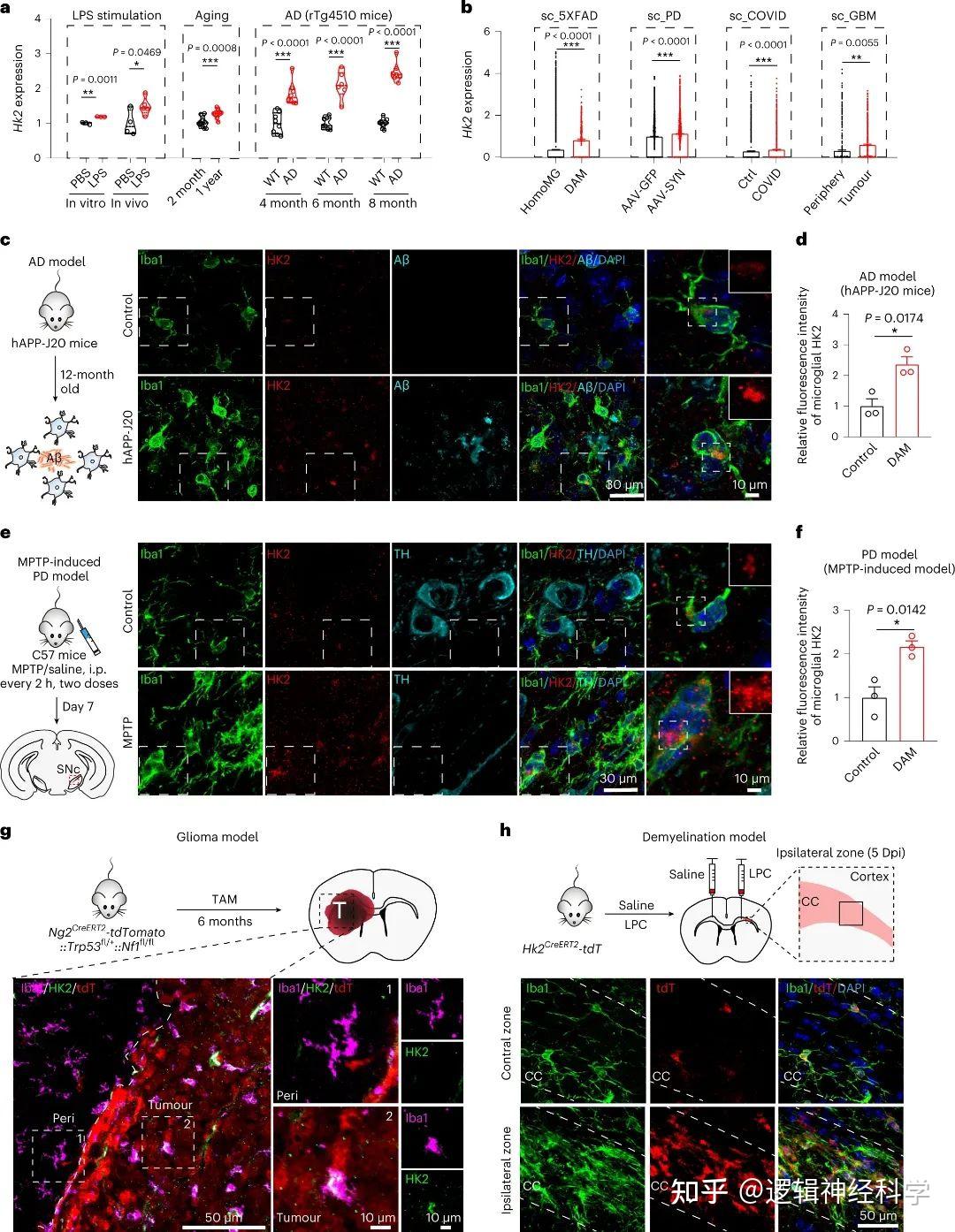 Nat Metab︱浙江大学医学院脑科学与脑医学学院高志华/段树民课题组揭示糖代谢关键酶Ⅱ型己糖激酶调控小胶质细胞功能的新机制 - 知乎