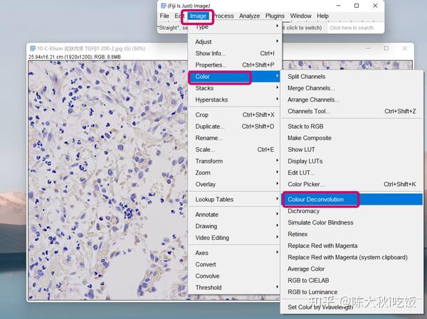 如何使用image j定量免疫组化阳性区域 - 知乎