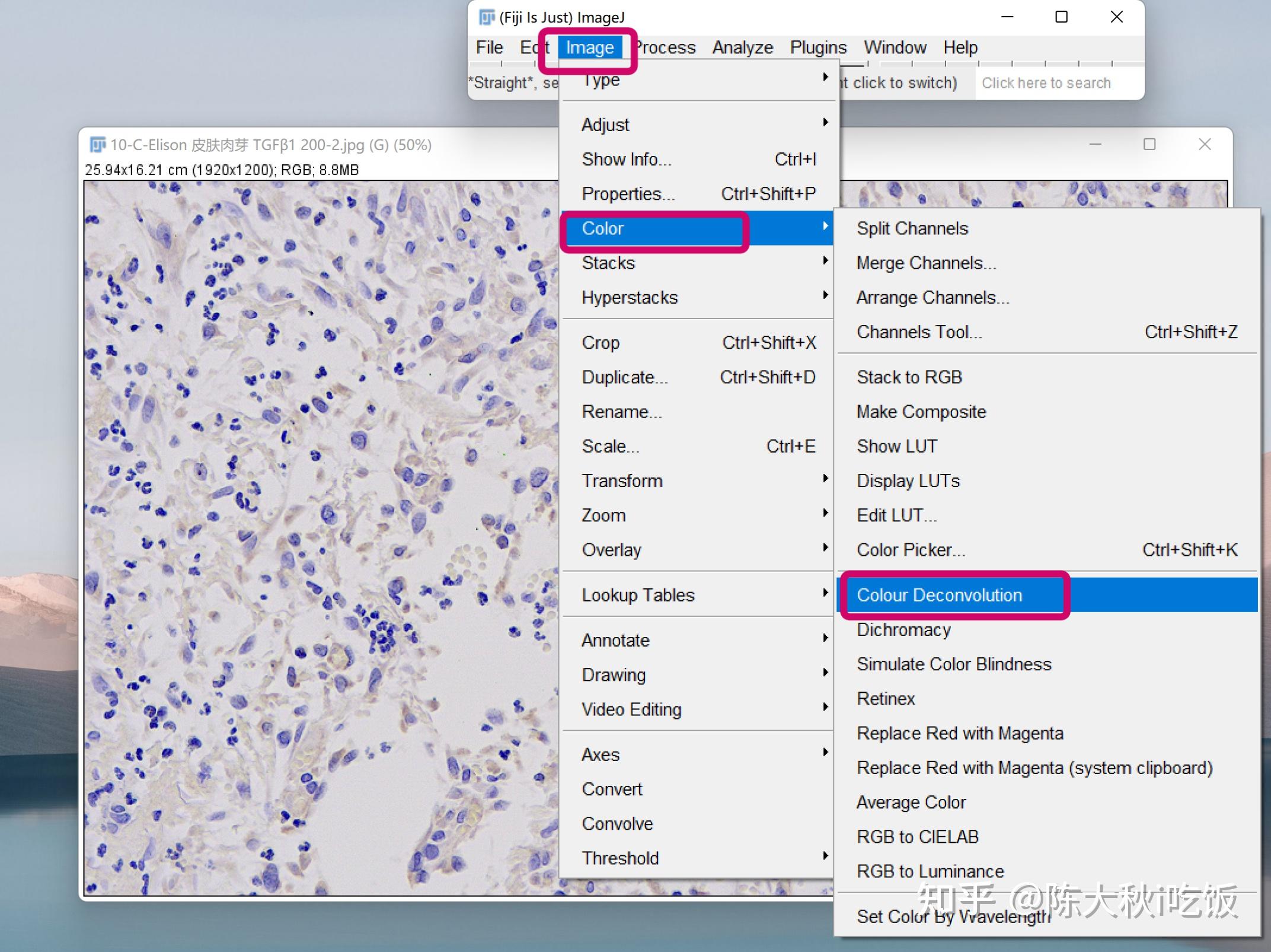 如何使用image j定量免疫组化阳性区域 - 知乎