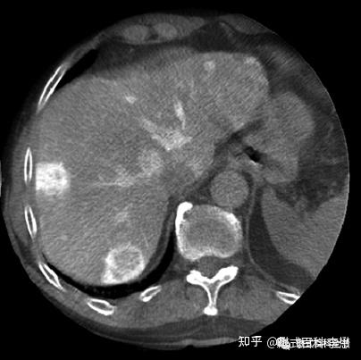 什么是CBCT？它和CT有什么区别？ - 知乎