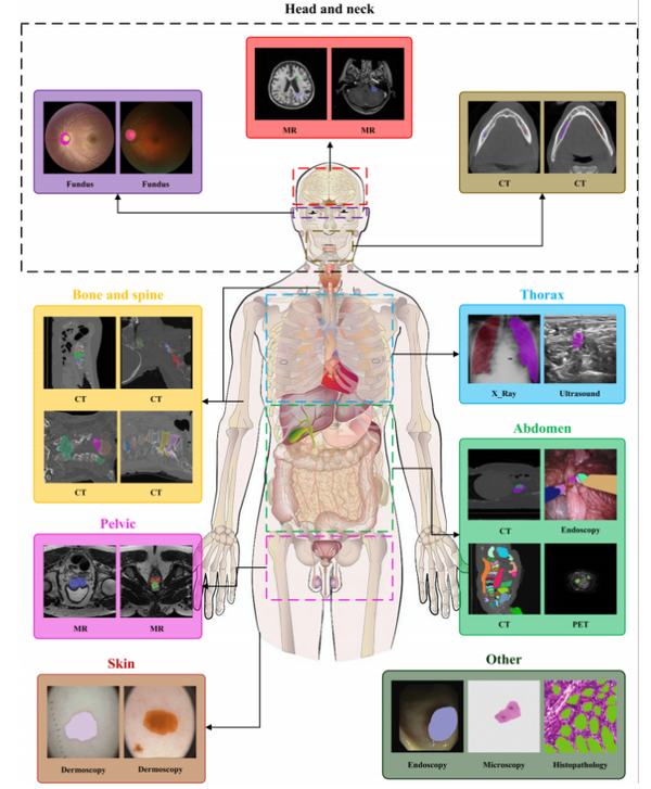 SAM-Med2D数据开源！超大规模医学分割数据集SA-Med2D-20M可下载 - 知乎