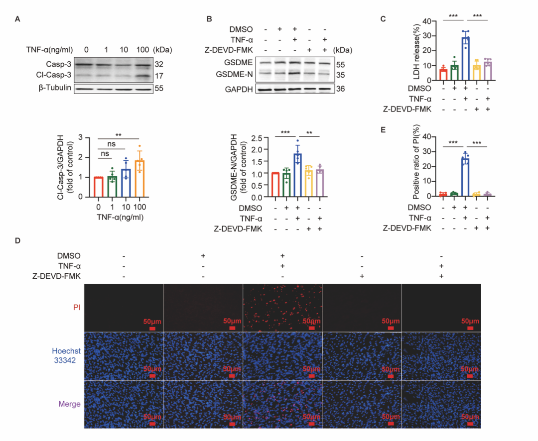 Cell Death Discov︱福医大附院谢良地团队揭示肌少症中TNF-α调控骨骼肌细胞发生细胞焦亡的分子机制 - 知乎