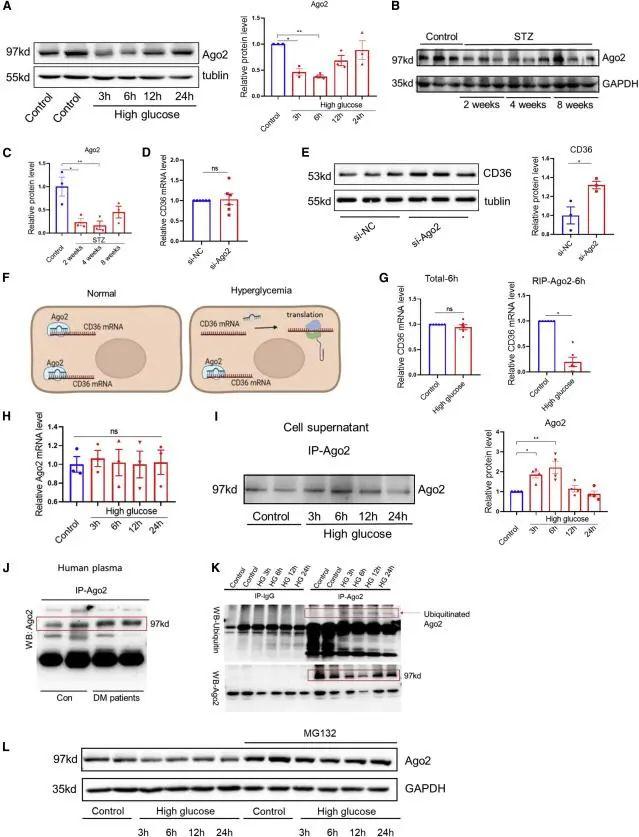 华中同济医院最新糖尿病心肌病(DCMP)模式动物实验发现MiR-320和CD36正反馈回路 - 知乎