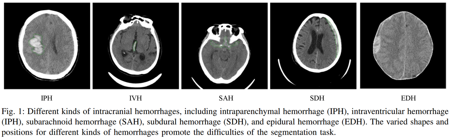 INSTANCE 2022 数据集介绍 - 知乎