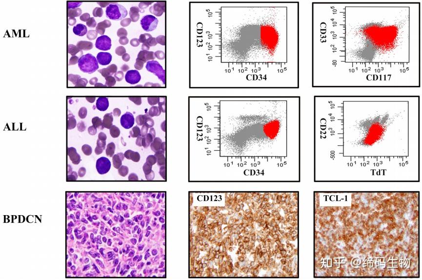 肿瘤免疫靶点｜CD123 - 知乎