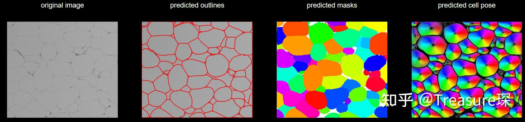 ImageJ实用教程——边缘检测图像分割(案例分析篇) - 知乎