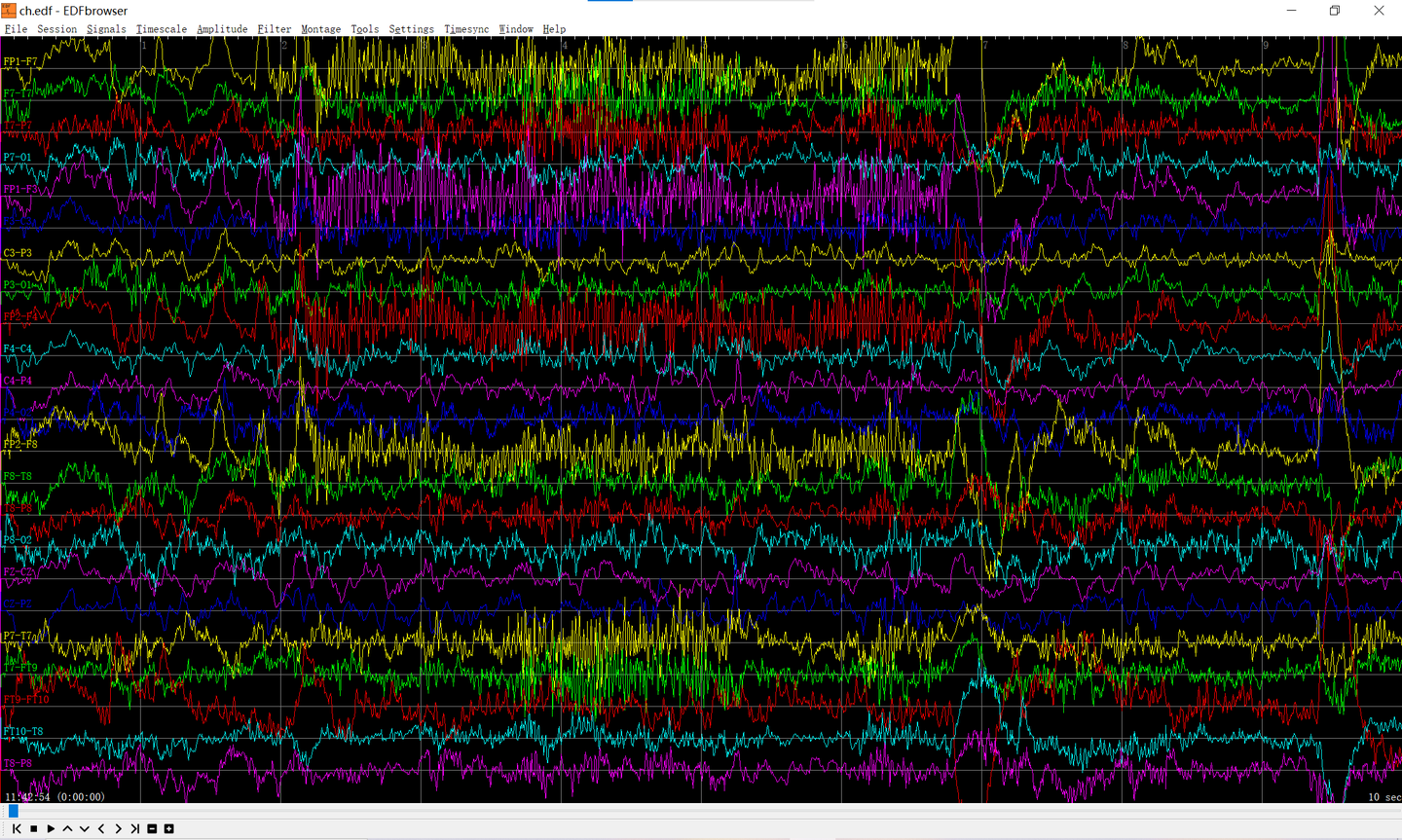读开源项目学QT - 脑机接口Edfbrowser - 知乎