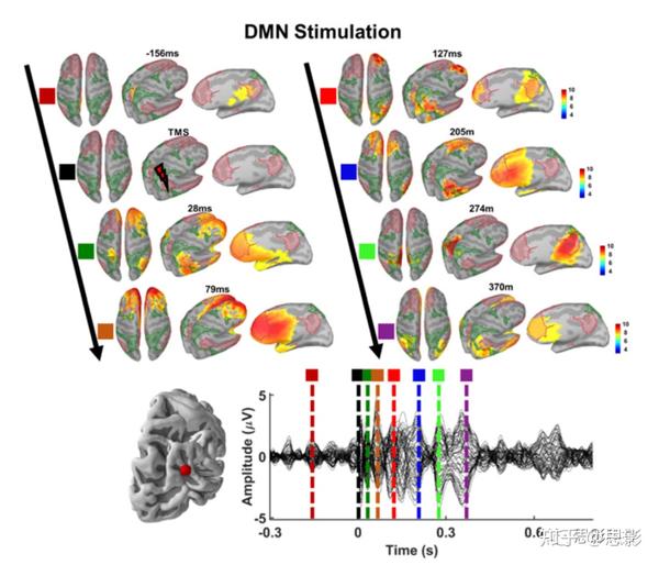 PNAS脑电+fMRI+TMS研究：人类连接体个体化扰动揭示了与认知相关的可复现的网络动态生物标记物 - 知乎