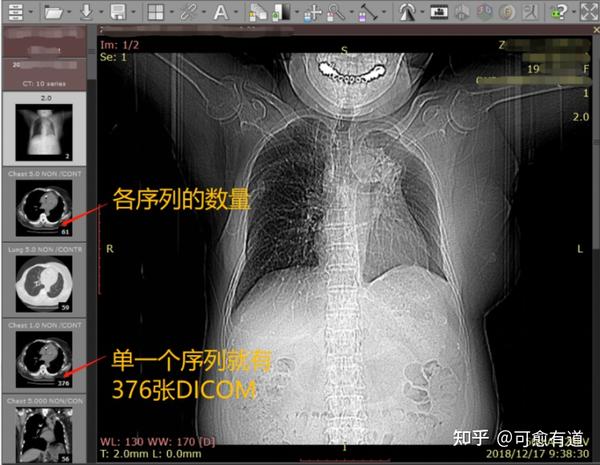 什么是DICOM格式医学影像？如何获取？ - 知乎