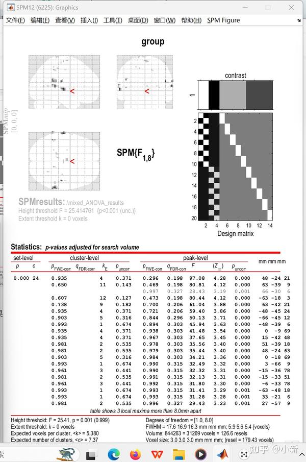 14-SPM-fmri任务态 二阶分析：mixed anova混合方差分析 - 知乎