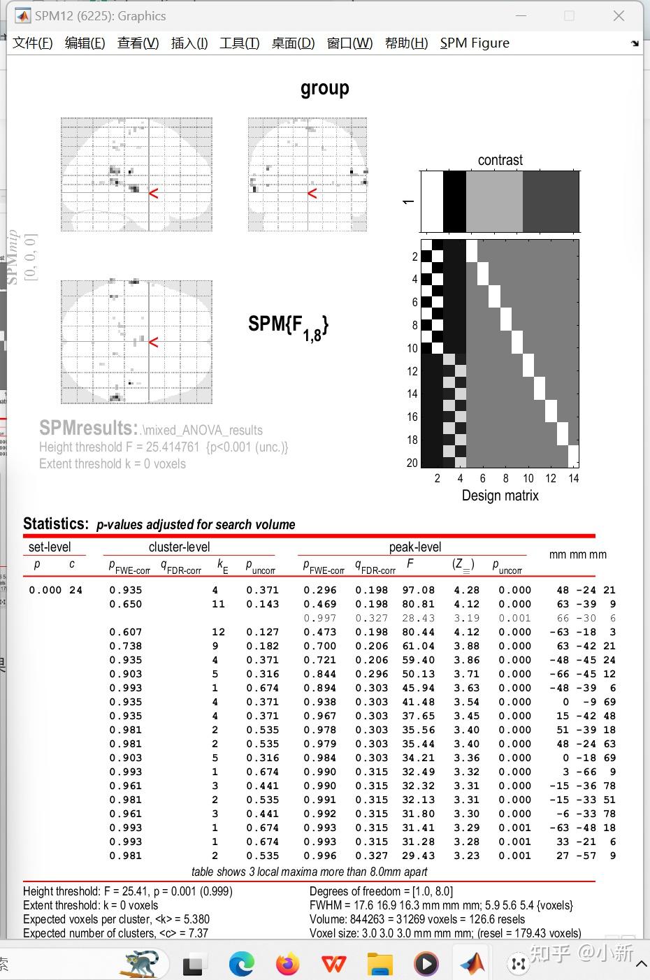 14-SPM-fmri任务态 二阶分析：mixed anova混合方差分析 - 知乎