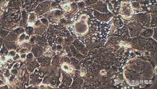 【整理】Caco-2人结直肠腺癌细胞培养经验 - 知乎