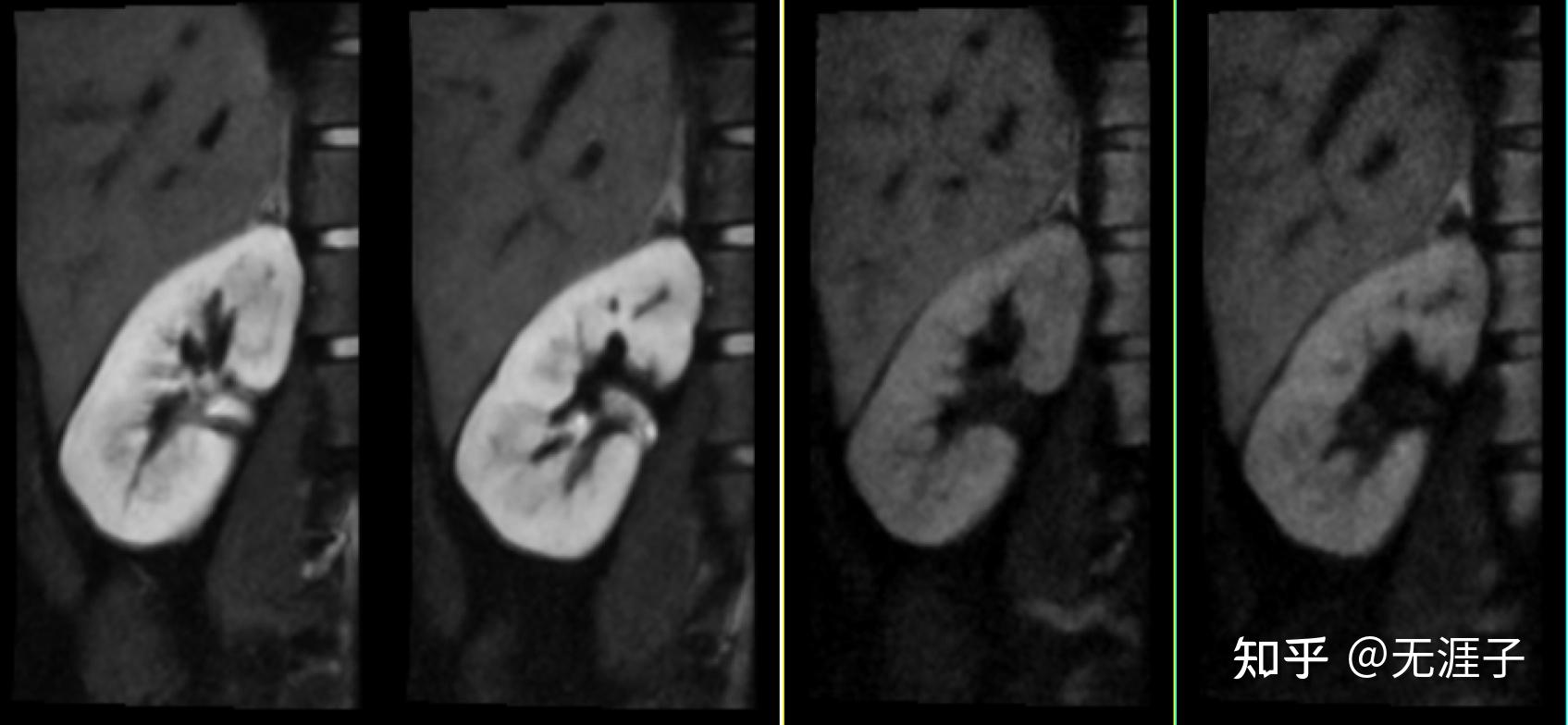 MRI 美图share - 知乎