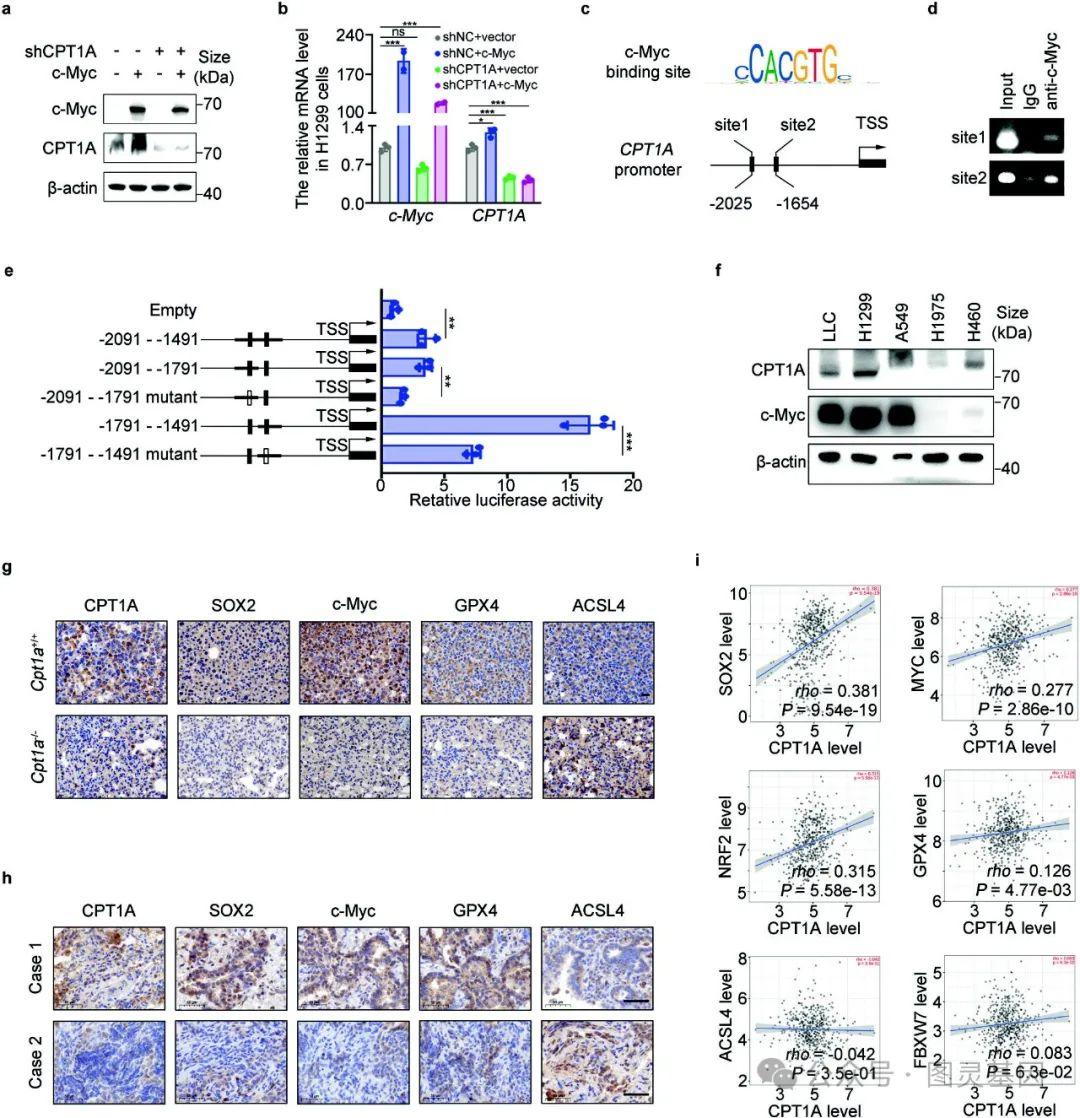 STTT | 靶向CPT1A可诱导铁死亡并与肺癌免疫治疗产生协同作用 - 知乎